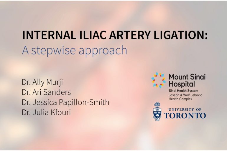 Internal Iliac Artery Ligation: A Stepwise Approach