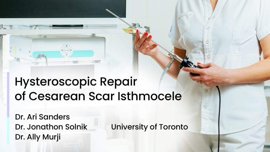 [VIDEO] Hysteroscopic Repair of Cesarean Scar Isthmocele
