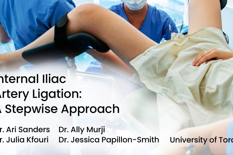 [video] Uterosacral Ligament Suspension During Hysterectomy