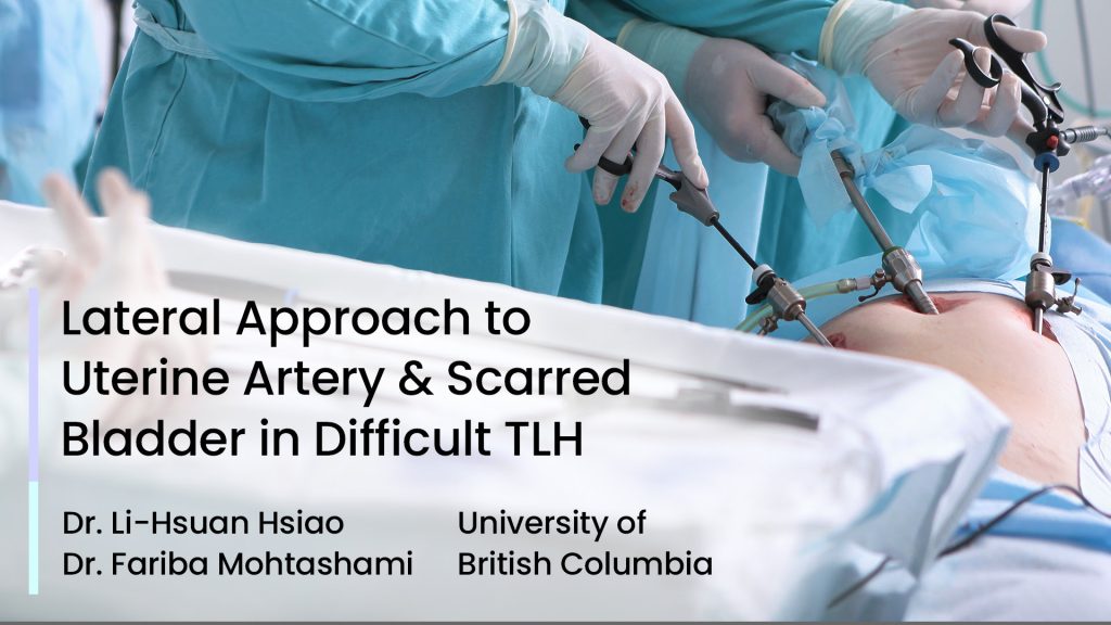 [VIDEO] Lateral Approach to Uterine Artery & Scarred Bladder