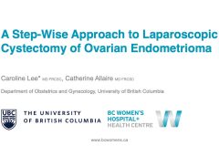 A Step-wise Approach to Laparoscopic Cystectomy