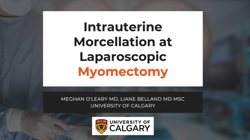 Intrauterine Morcellation at Laparoscopic Myomectomy