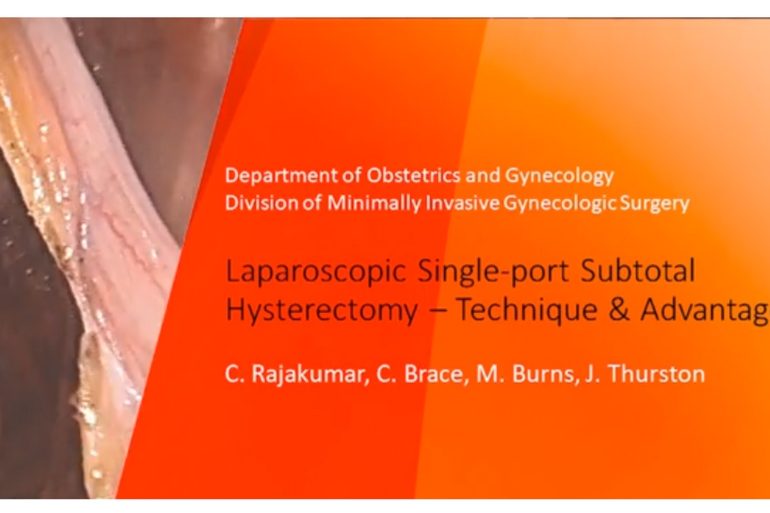 Laparoscopic Single Port Subtotal Hysterectomy