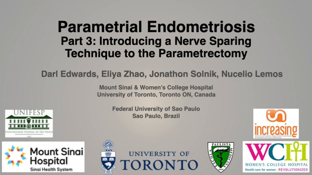 Introducing a Nerve Sparing Technique to the Parametrectomy
