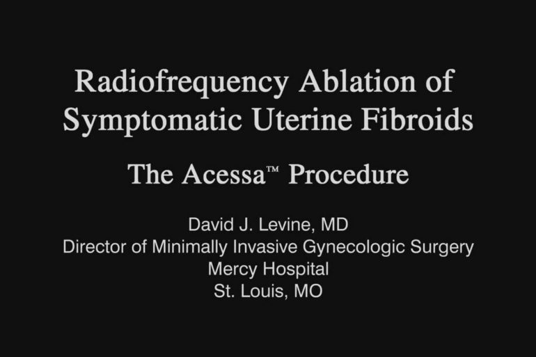 Radiofrequency Ablation of Symptomatic Uterine Fibroids