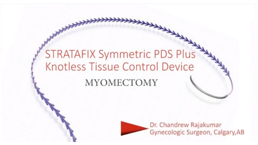 STRATAFIX Symmetric PDS Plus Knotless Tissue Control Device STRATAFIX Symmetric PDS Plus Knotless Tissue Control Device