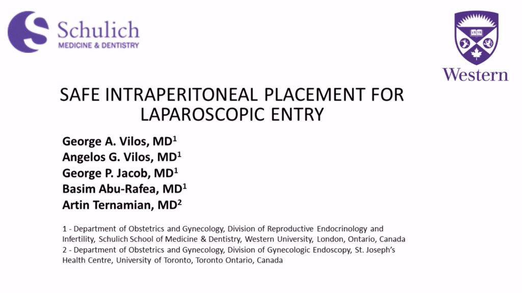Safe Intraperitoneal Placement for Laparoscopic Entry