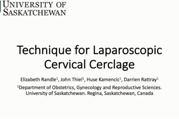 Technique for Laparoscopic Cervical Cerclage