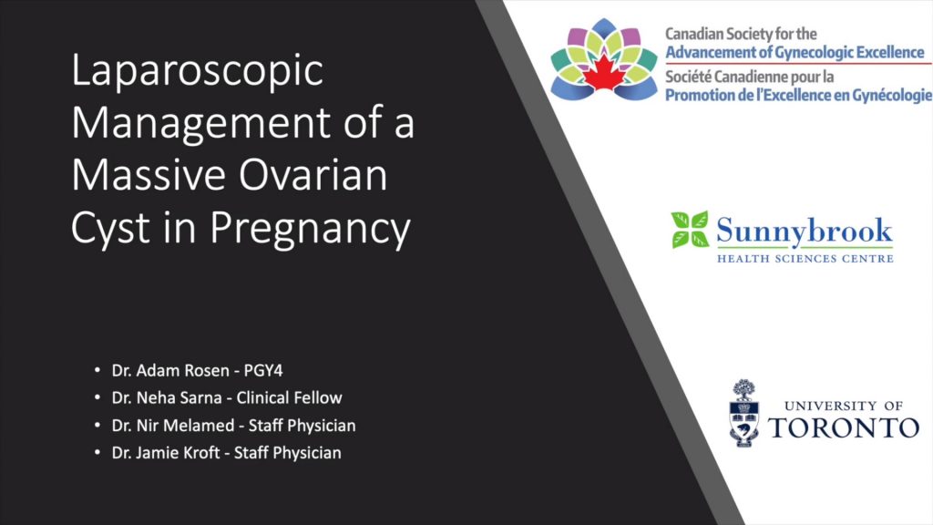 Laparoscopic Management of a Massive Ovarian Cyst in Pregnancy
