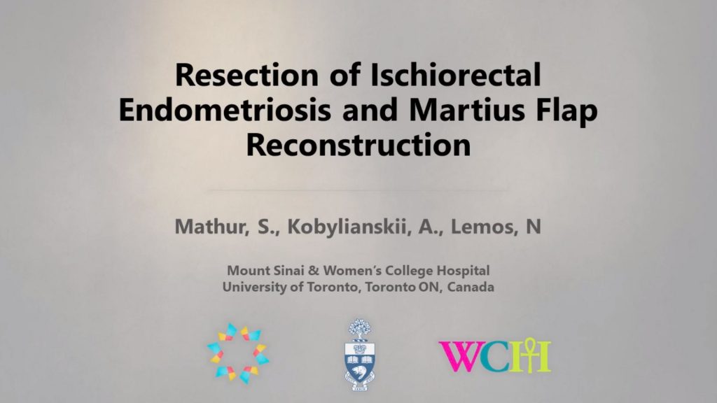Resection of Ischiorectal Endometriosis and Martius Flap Reconstruction