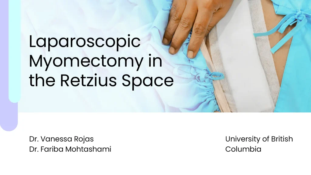 [VIDEO] Laparoscopic Myomectomy in the Retzius Space