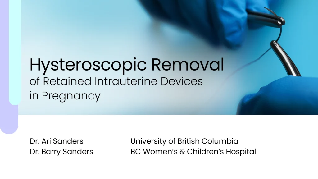 Removal of Retained Intrauterine Devices in Pregnancy