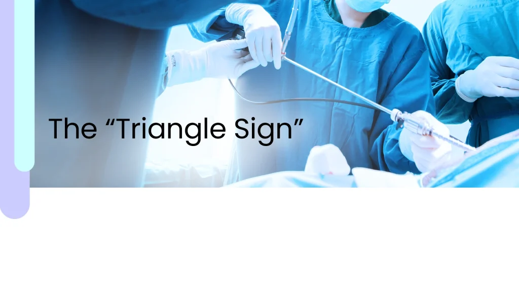 Introducing the Dynamic 'Triangle Sign' Technique