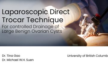 [VIDEO] Uterosacral Ligament Suspension During Hysterectomy