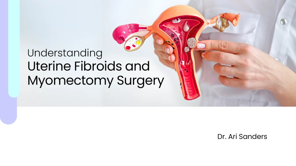 Understanding Uterine Fibroids and Myomectomy Surgery