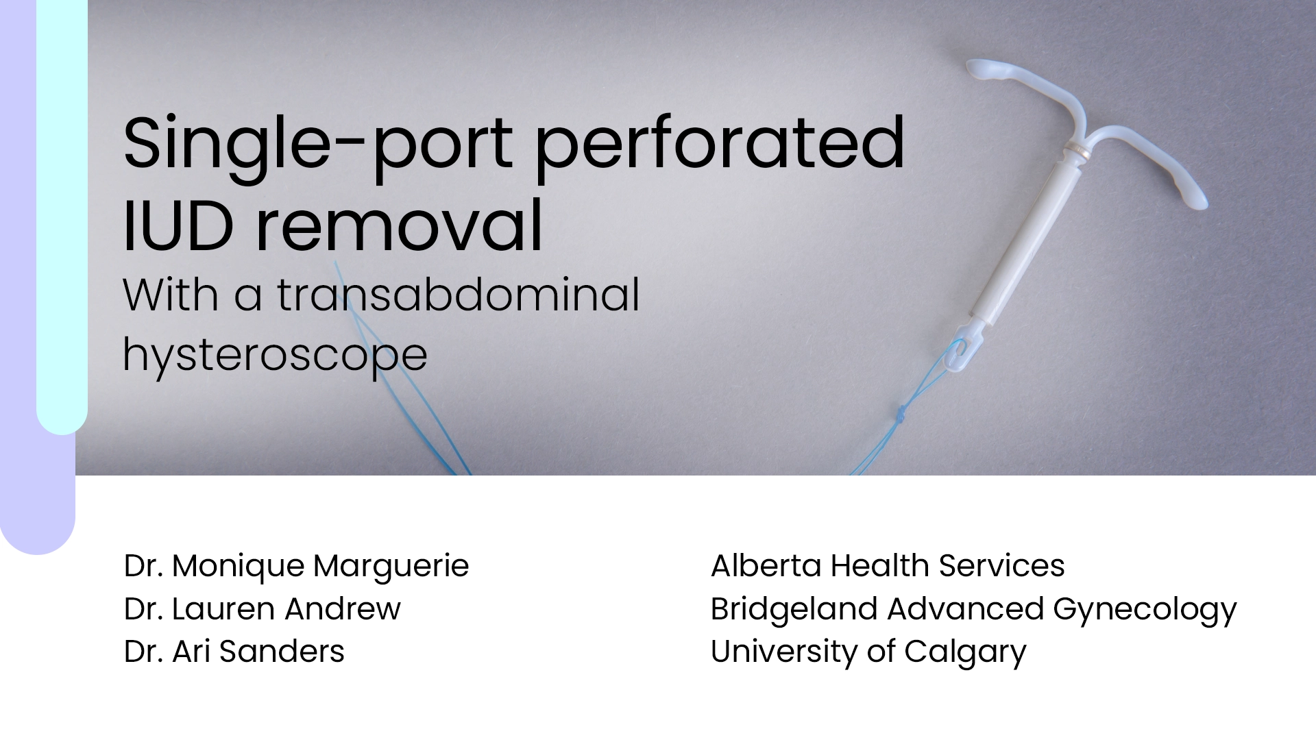 Single-Port IUD Removal via Hysteroscope